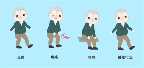 脚凉？脚麻？间歇性跛行？可能是下肢动脉硬化闭塞症 症状 血管 行走