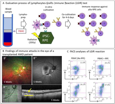 Evaluation Of Immune Reaction Against Allogeneic Ipsc Derived Rpe Cell Download Scientific