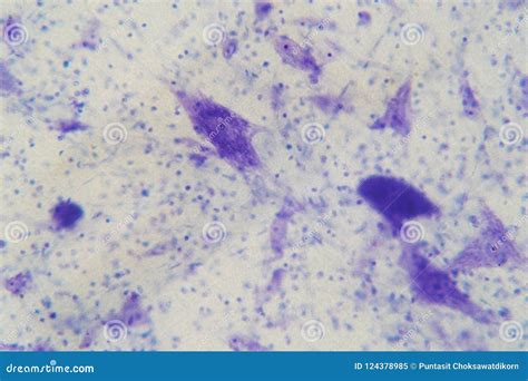 Neurons Cells From The Brain Under The Microscope View Stock Image Image Of Medical Dendrite