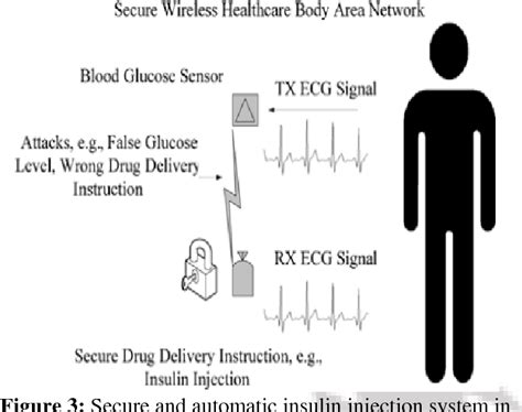 Figure 3 From Reliable Ecg Signals Based On Gmm For Body Area Network Semantic Scholar
