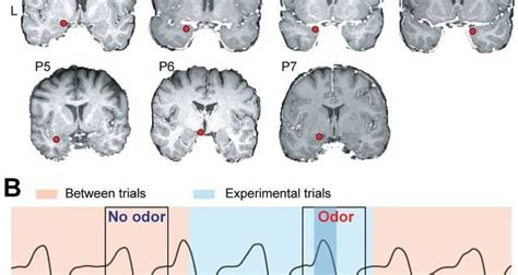 Olfactory Processing In Three Distinct Neural Waves Worldmedicinefoundation
