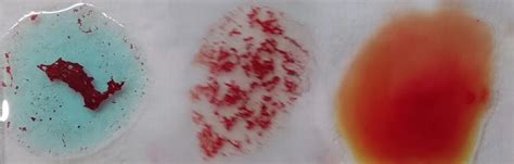 Blood Group Detection Object Detection Model By Minor Project 5th Semester