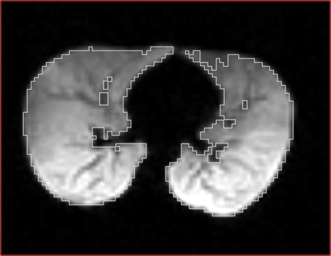 Modulesn4itkbiasfieldcorrection Documentation 36 Slicer Wiki
