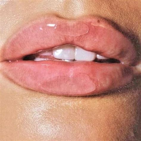 Talking In Tongues Your Bodys Secret Language In 2024 Lip Gloss Lips Fuller Aesthetic Clinic