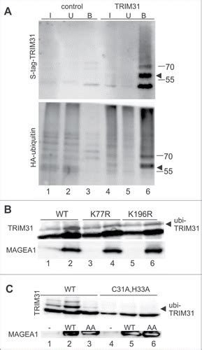 Full Article The Melanoma Associated Antigen 1 Magea1 Protein