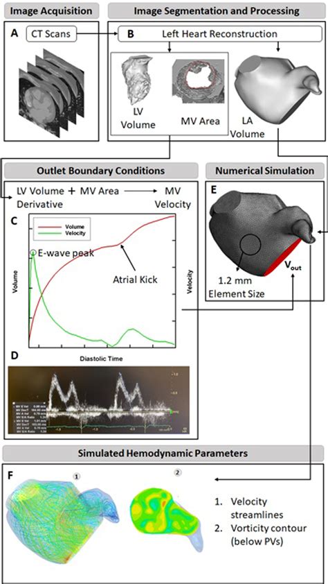 Overall workflow adopted in this study Computed tomography ⁴ scans Download Scientific Diagram