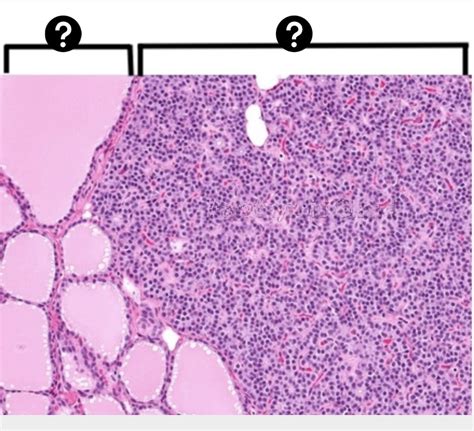Thyroid Gland Histology Diagram Quizlet
