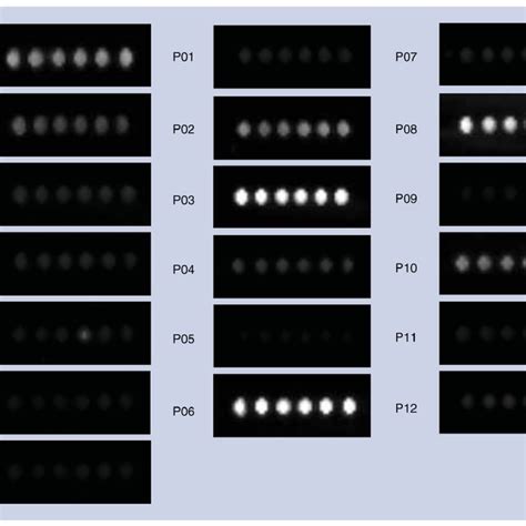 Representation Of The Bio Barcode Amplification Method And The