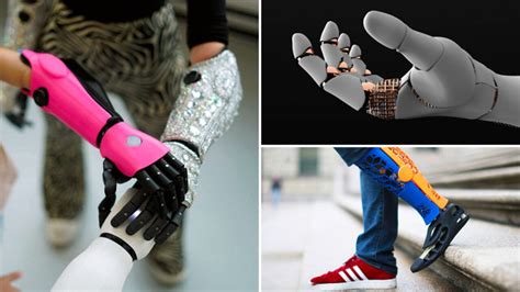Bionic Limbs 2022