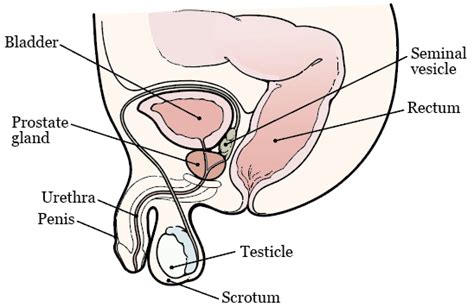 About Your Prostate Fiducial Marker Placement Memorial Sloan Kettering Cancer Center