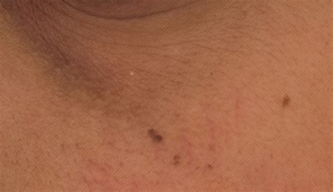 Female 077 Albedo Map