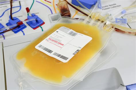 Rethinking Prophylactic Platelet Transfusions In Neonates