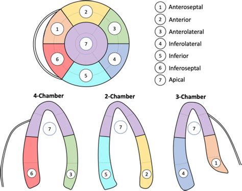 Echocardiographic Detection Of Regional Wall Motion Abnormalities Using