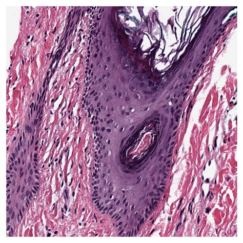 Stain Normalization TIA Toolbox Documentation