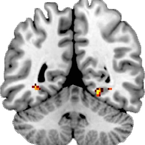 Multivariate Fmri Results A Logistic Regression Mvpa Classifier Download Scientific Diagram