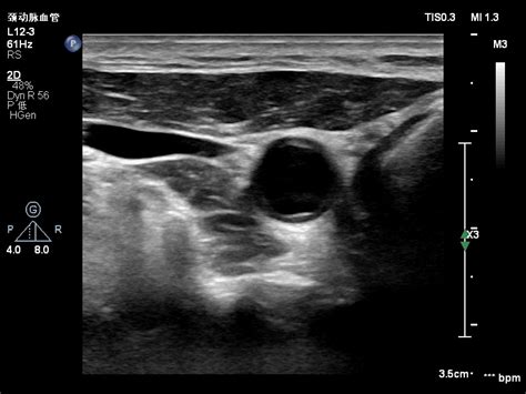 Segmentation2 Semantic Segmentation Dataset By Quik