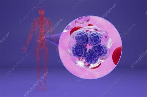 T Cell Lymphoma Illustration Stock Image F043 8373 Science Photo Library