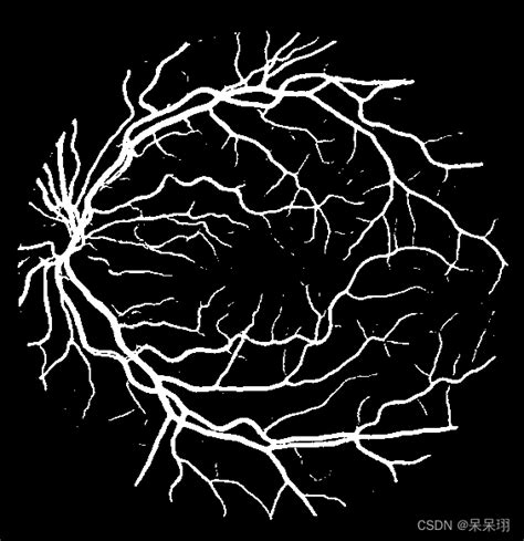 unet rknn分割眼底血管 眼底血管分割 csdn博客
