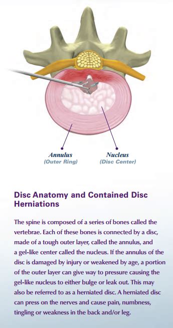 Disc Fx Nona Medical Arts