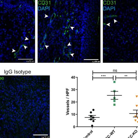 Msc Derived Ccl2 Is Also Required For Angiogeneic Response