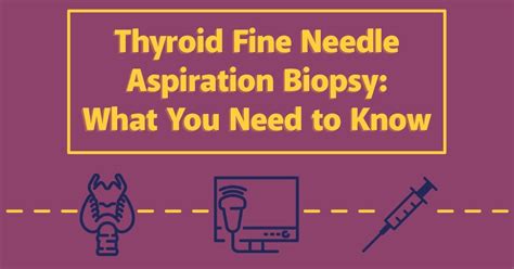 Thyroid Fine Needle Aspiration Biopsy What You Need To Know Uva Radiology