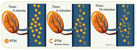 Intraoperative Parathyroid Hormone Pth Testing Dr Babak Larian