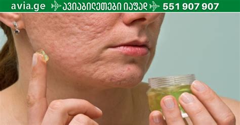 მოამზადეთ ეს ხელნაკეთი ნაწიბურების მოსაშორებელი კრემი სულ რაღაც 10 წამში და გაახალგაზრდავეთ