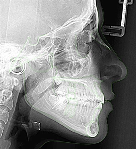 Reliability And Accuracy Of Artificial Intelligence Based Software For