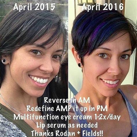 See Real Results With Rf Multifunction Eye Cream