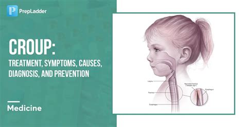 Croup Treatment Symptoms Causes Diagnosis And Treatment