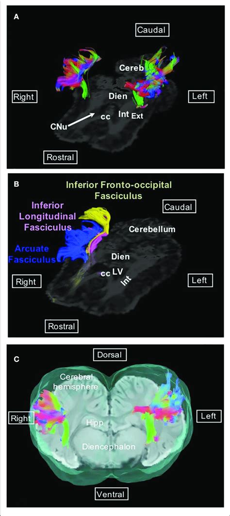 Arcuate Fasciculus A Dorsal View Of The Arcuate Fasciculus