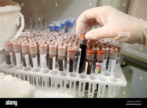 Frozen blood samples stored samples in refrigerator at 80º C DNA and