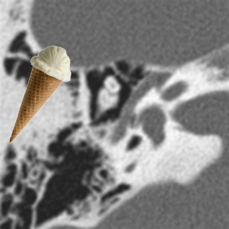 Everything Youve Wanted To Know About Temporal Bone Imaging But Were