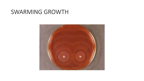 Shigella Klebsiella Proteus Pseudomonas Pptx