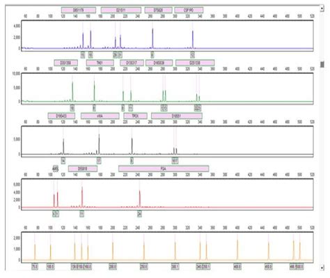 Electropherogram Showing Results Of Str Typing Download Scientific Diagram