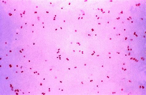 Gram Negative Bacteria Microscope