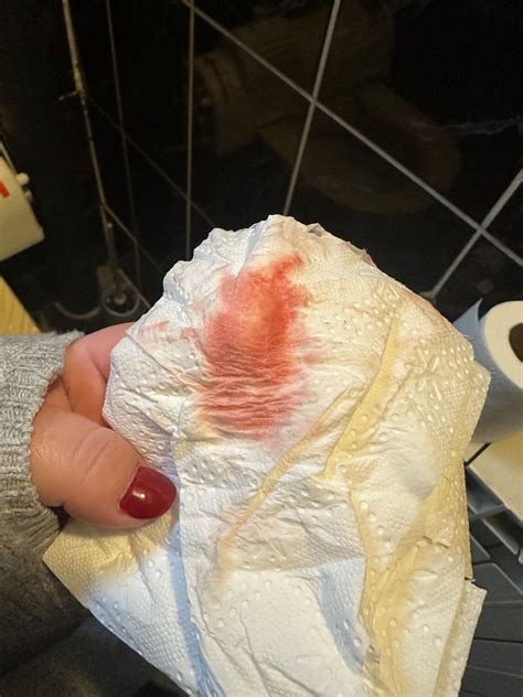 Implantation Bleeding BabyCenter