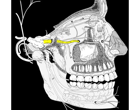 Maxillary Nerve V2 Lateral View Quiz