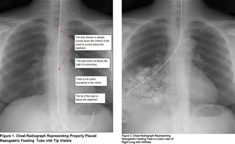 Theory Quiz 2 Flashcards Quizlet