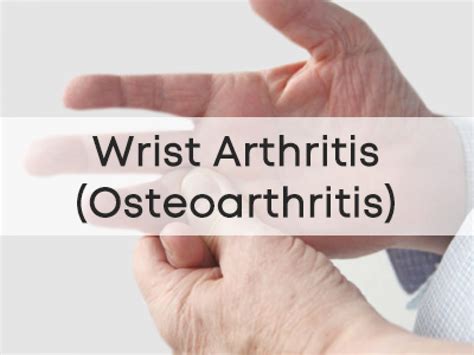 Osteoarthritis Wrist