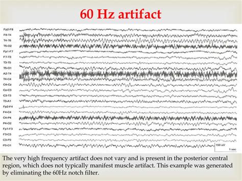 EEG Artifacts PPTX
