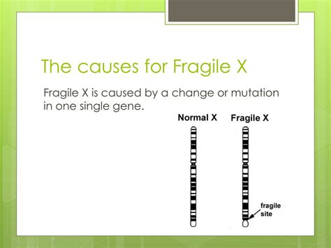 PPT Fragile X Syndrome PowerPoint Presentation Free Download ID