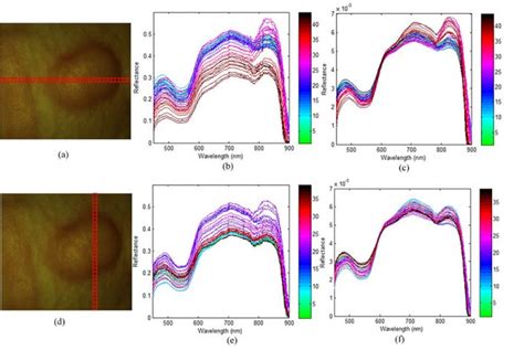 Spectral Spatial Classification Methods For Tumor Detection