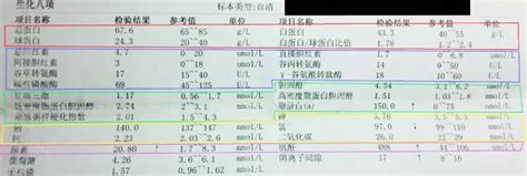 血生化检验单如何快速看懂 血浆