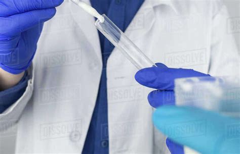 Medical Laboratory Assistant Checks A Test Tube With Sperm Spermogram Male Fertility Test