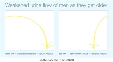 Strong Urine Stream Young Man Healthy Stock Vector Royalty Free