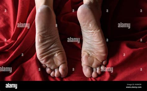 Calluses On The Feet Woman Stock Photo Alamy