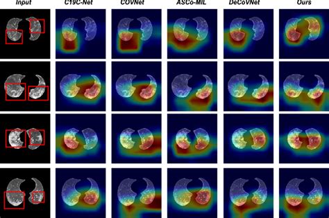 Qualitative Comparisons Between Ours C19c Net Bai Et Al 2020b Download Scientific Diagram