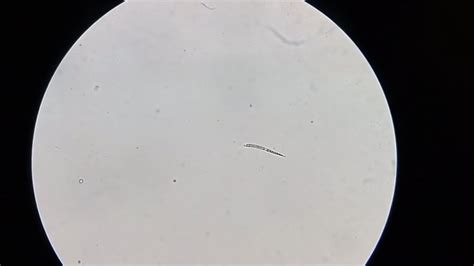 Can Someone Identify This R Microscopy