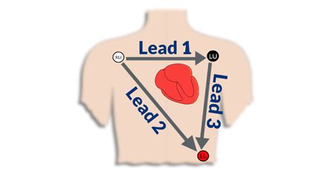3 Lead Ecg Nursing Unraveled